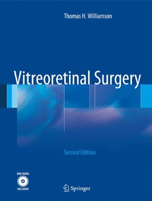 【预订】Vitreoretinal Surgery