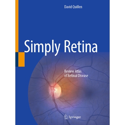 预订 Simply Retina Review Atlas of Retinal Disease 简明视网膜：视网膜疾病综述图集 9783031660917