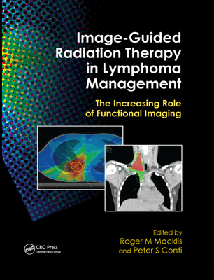 【预订】Image-Guided Radiation Therapy in Lymphoma Management: The Increasing Role of Functional Imaging