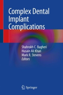 【预订】Complex Dental Implant Complications 9783030470142