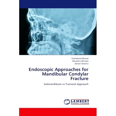 预订 Endoscopic Approaches for Mandibular Condylar Fracture 下髁骨折的内镜入路: 9786207471362