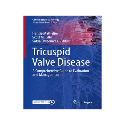 [预订]Tricuspid Valve Disease 9783030920456