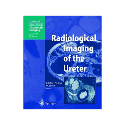 预订 Radiological Imaging of the Ureter