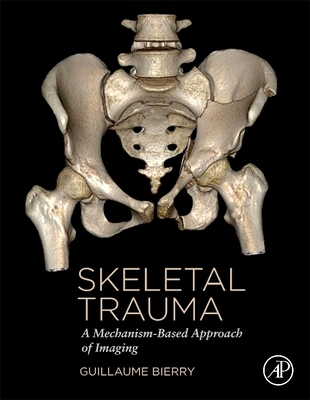 【预订】Skeletal Trauma: A Mechanism-Based Approach of Imaging