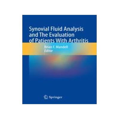 [预订]Synovial Fluid Analysis and The Evaluation of Patients With Arthritis 9783030996147
