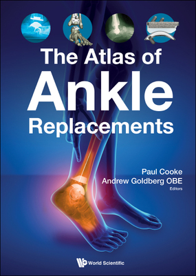 【预订】Atlas of Ankle Replacements, the