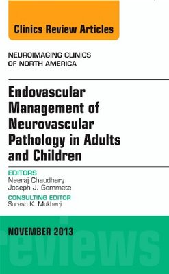 【预订】Endovascular Management of Neurovascular Pathology in Adults and Children, An Issue of Neuroimaging Clinics