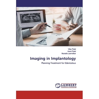 预订 Imaging in Implantology:Planning Treatment for Edentulous: Planning Treatment for Edentulous 种植学影像学:计划性治