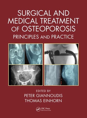 【预订】Surgical and Medical Treatment of Osteoporosis