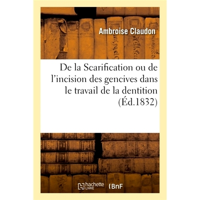 预订 De la Scarification ou de l’incision des gencives dans le travail de la dentition 牙列工作中牙龈的划伤或切开: 9782
