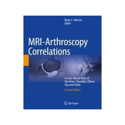 [预订]MRI-Arthroscopy Correlations 9783030947910