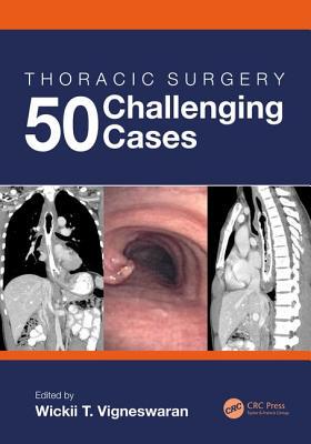 【预订】Thoracic Surgery: 50 Challenging cases