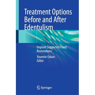 预订 Treatment Options Before and After Edentulism Implant Supported Fixed Restorations 无牙颌前后的治疗选择：种植体支持