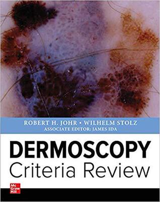 【预售】Dermoscopy Criteria Review