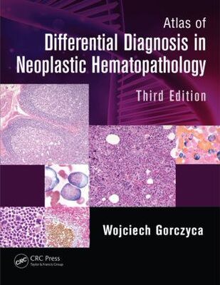 【预订】Atlas of Differential Diagnosis in Neoplastic Hematopathology, Third Edition