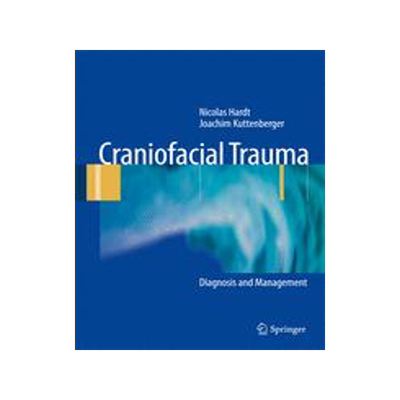 预订 Craniofacial Trauma