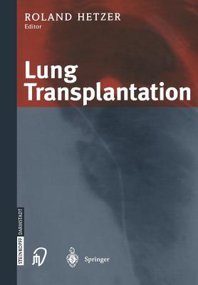 【预订】Lung Transplantation