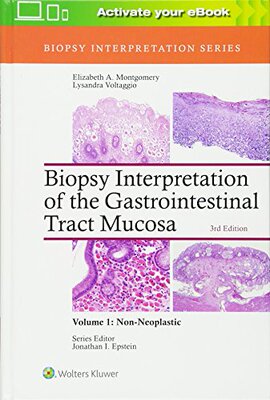 【预订】Biopsy Interpretation of the Gastrointestinal Tract Mucosa