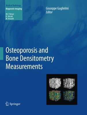 【预订】Osteoporosis and Bone Densitometry Measurements