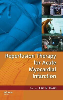 【预订】Reperfusion Therapy for Acute Myocardial Infarction
