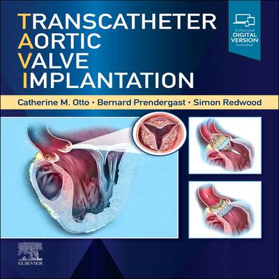 [预订]Transcatheter Aortic Valve Implantation