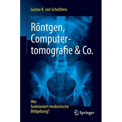 预订 Röntgen, Computertomografie & Co. Wie funktioniert medizinische Bildgebung? 9783662539309