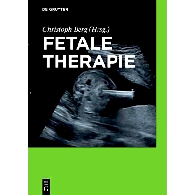 预订 Fetale Therapie: 9783110438413