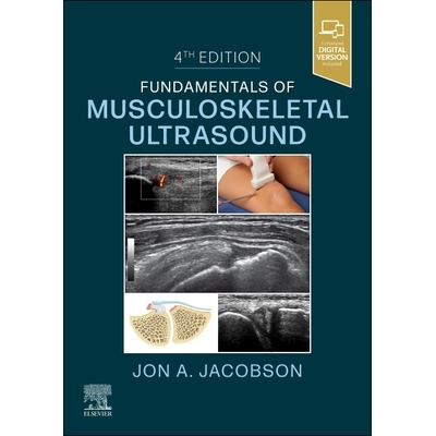 预订 Fundamentals of Musculoskeletal Ultrasound 肌肉骨骼超声基础 9780323791502