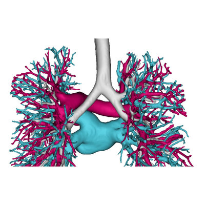 mimics部位动静脉重建医学图像处理3dslicer vtk itk解剖分析代做