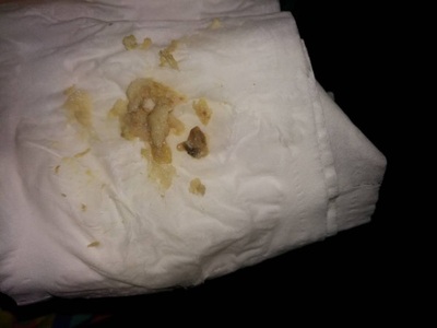 月经少月经色黑祛宫寒湿气白带多味重腐靡霉莙网红款滋养hvp干扰