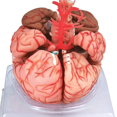 脑动脉模型GD/A18220