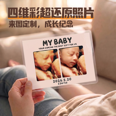 宝宝B超nt四维彩超打印还原纪念照孕期定制宫格拼图6寸塑封照片