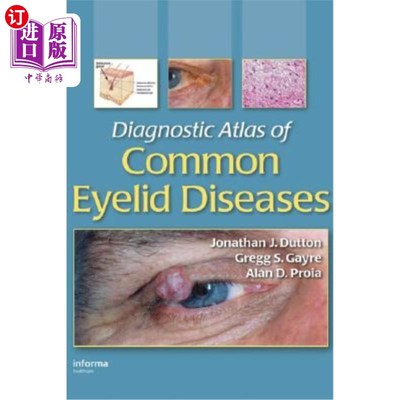 海外直订医药图书Diagnostic Atlas of Common Eyelid Diseases 常见眼睑疾病诊断图集
