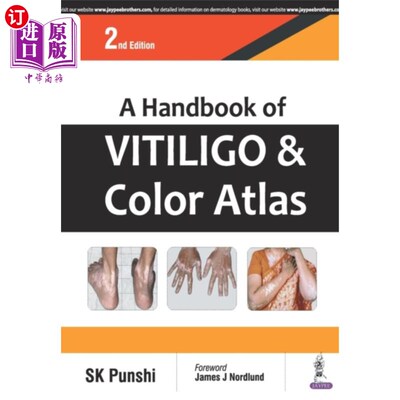 海外直订医药图书Handbook of Vitiligo & Color Atlas 白癜风彩色图集手册