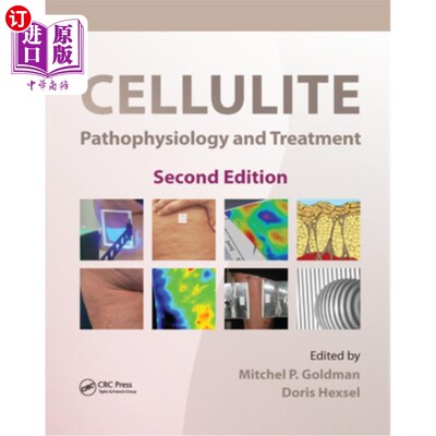 海外直订医药图书Cellulite: Pathophysiology and Treatment 脂肪团:病理生理与治疗