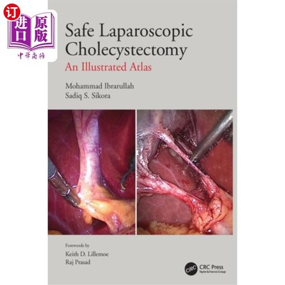 海外直订医药图书Safe Laparoscopic Cholecystectomy 安全的腹腔镜胆囊切除术