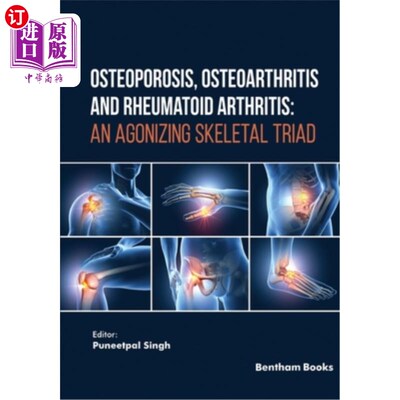 海外直订医药图书Osteoporosis, Osteoarthritis and Rheumatoid Arthritis: An Agonizing Skeletal Tri 骨质疏松、骨关节炎