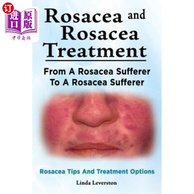 海外直订医药图书Rosacea and Rosacea Treatment. From A Rosacea Sufferer To A Rosacea Sufferer. Ro 酒渣鼻和酒渣鼻治疗