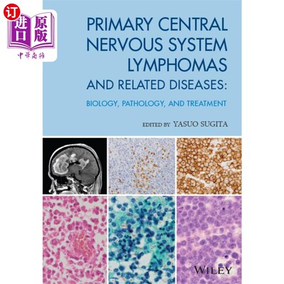 海外直订日语 ＰＲＩＭＡＲＹ　ＣＥＮＴＲＡＬ　ＮＥＲＶＯＵＳ　ＳＹＳＴＥＭ　ＬＹＭＰＨＯＭＡＳ　ＡＮＤ　ＲＥＬＡＴＥ