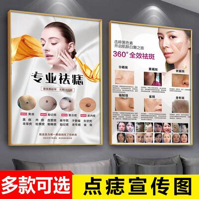 专业祛痣点痣宣传图美容院痣相图海报画男女面痣全效祛斑广告贴纸