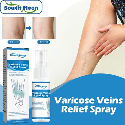 South Moon Varicose Vein Massage Spray for Legs - Relieves a
