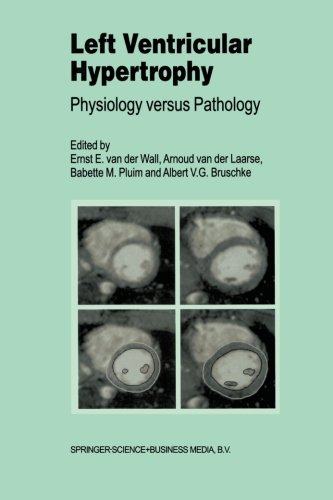 【预订】Left Ventricular Hypertrophy: Physio..._虎窝淘