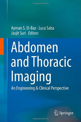 【预售】Abdomen and Thoracic Imaging: An Engineering &...