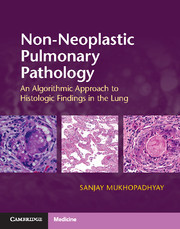 【预订】Non-Neoplastic Pulmonary Pathology w...