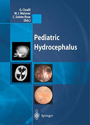 【预订】Pediatric Hydrocephalus