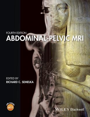 【预订】Abdominal-Pelvic Mri, 4/e