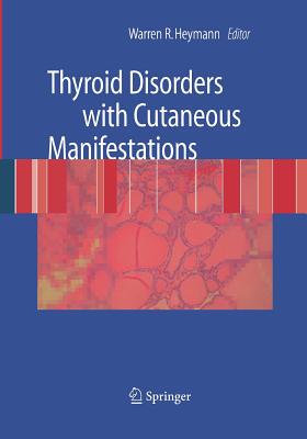 【预订】Thyroid Disorders with Cutaneous Man...