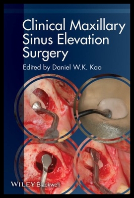 【预售】Clinical Maxillary Sinus Elevation Surgery