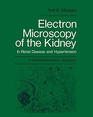 【预订】Electron Microscopy of the Kidney: I...