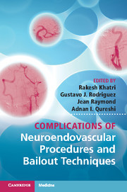 【预订】Complications of Neuroendovascular P...